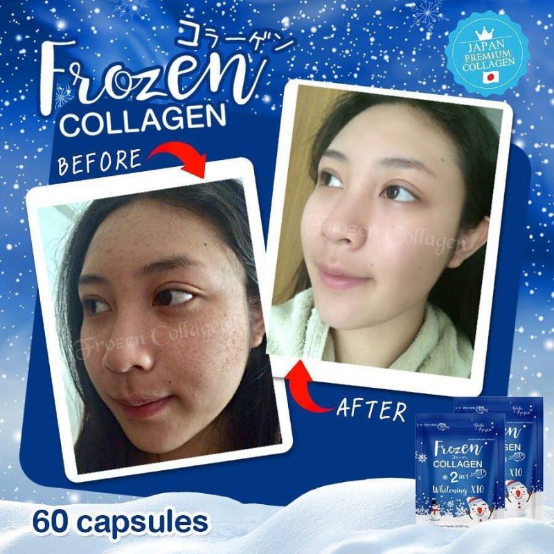Frozen Collagen by Gluta Frozen - Trust in Nature - www.stnature.com