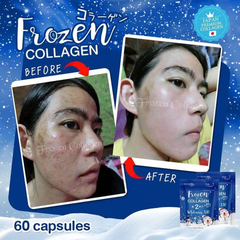 Frozen Collagen by Gluta Frozen - Trust in Nature - www.stnature.com